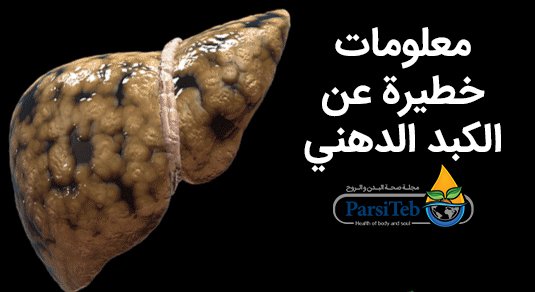 معلومات خطيرة عن الكبد الدهنينسبة الإصابة بالكبد الدهني في الدول